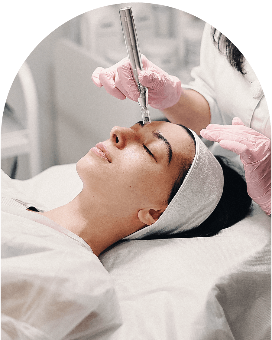 Microneedling - Estheticly The Skin Bar